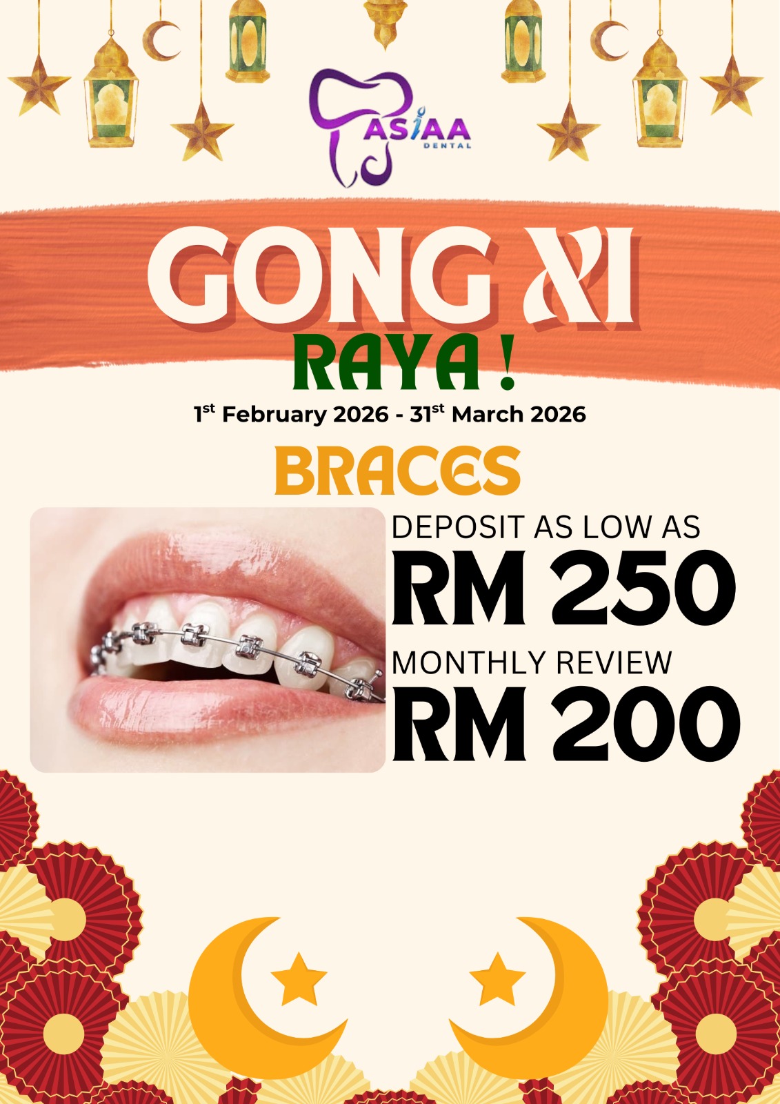 Dental Braces Johor Bahru | Customised Dental Braces JB | Dental Braces ...